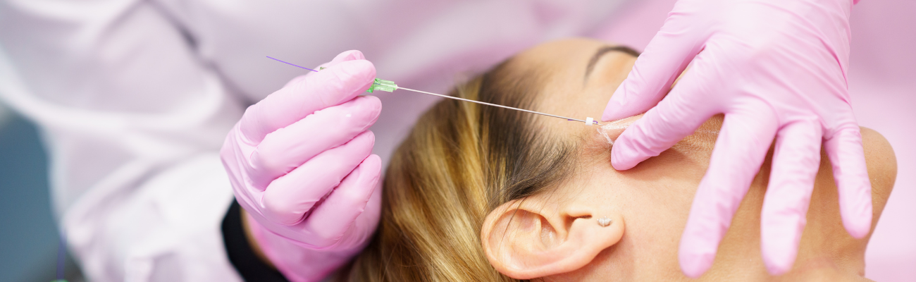 PDO Thread Lift: The Ultimate Guide to Non-Surgical Facial Rejuvenation ...