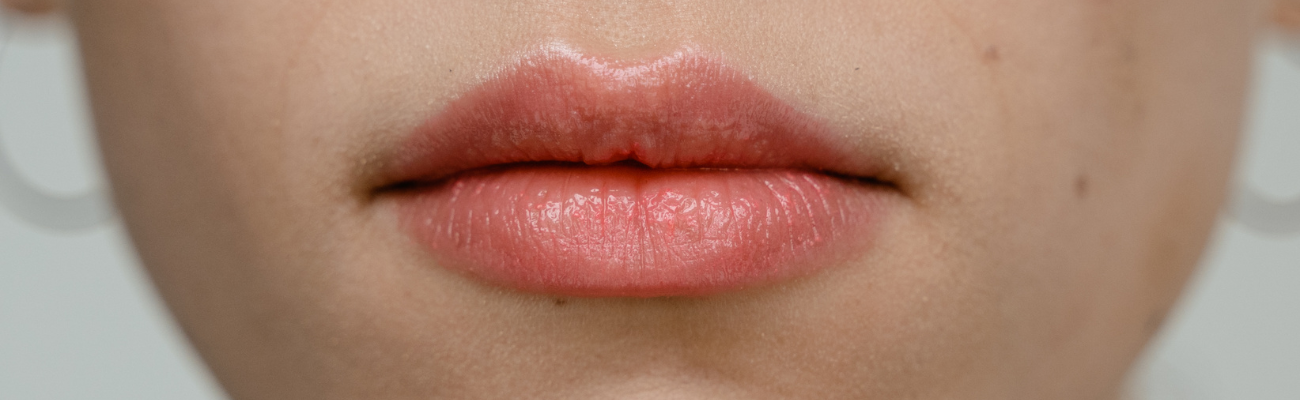 Can Your Body Reject Dermal Fillers? The Astonishing Truth Revealed ...