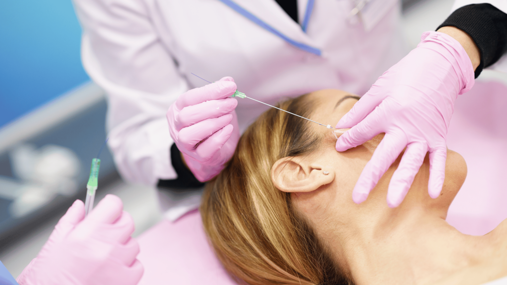 PDO Thread Lift Costs in the UK: A Comprehensive Guide - Advice, Tips ...